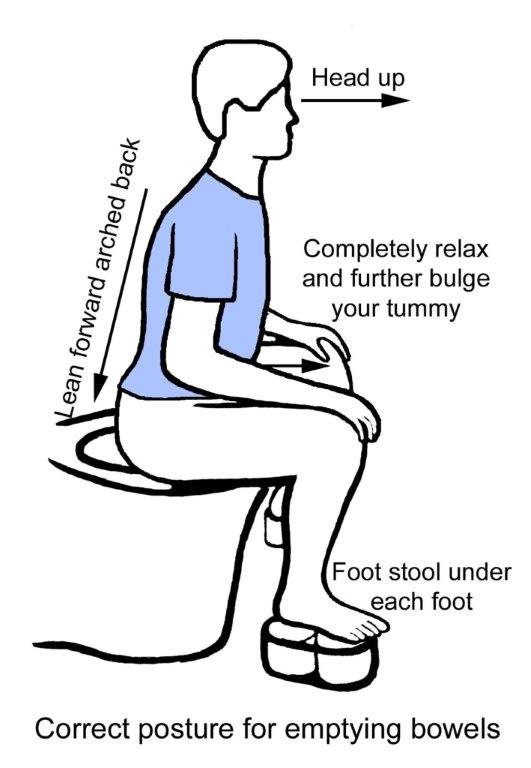 Tradies and pelvic floor dysfunction....What?!? - Active Women's Health ...