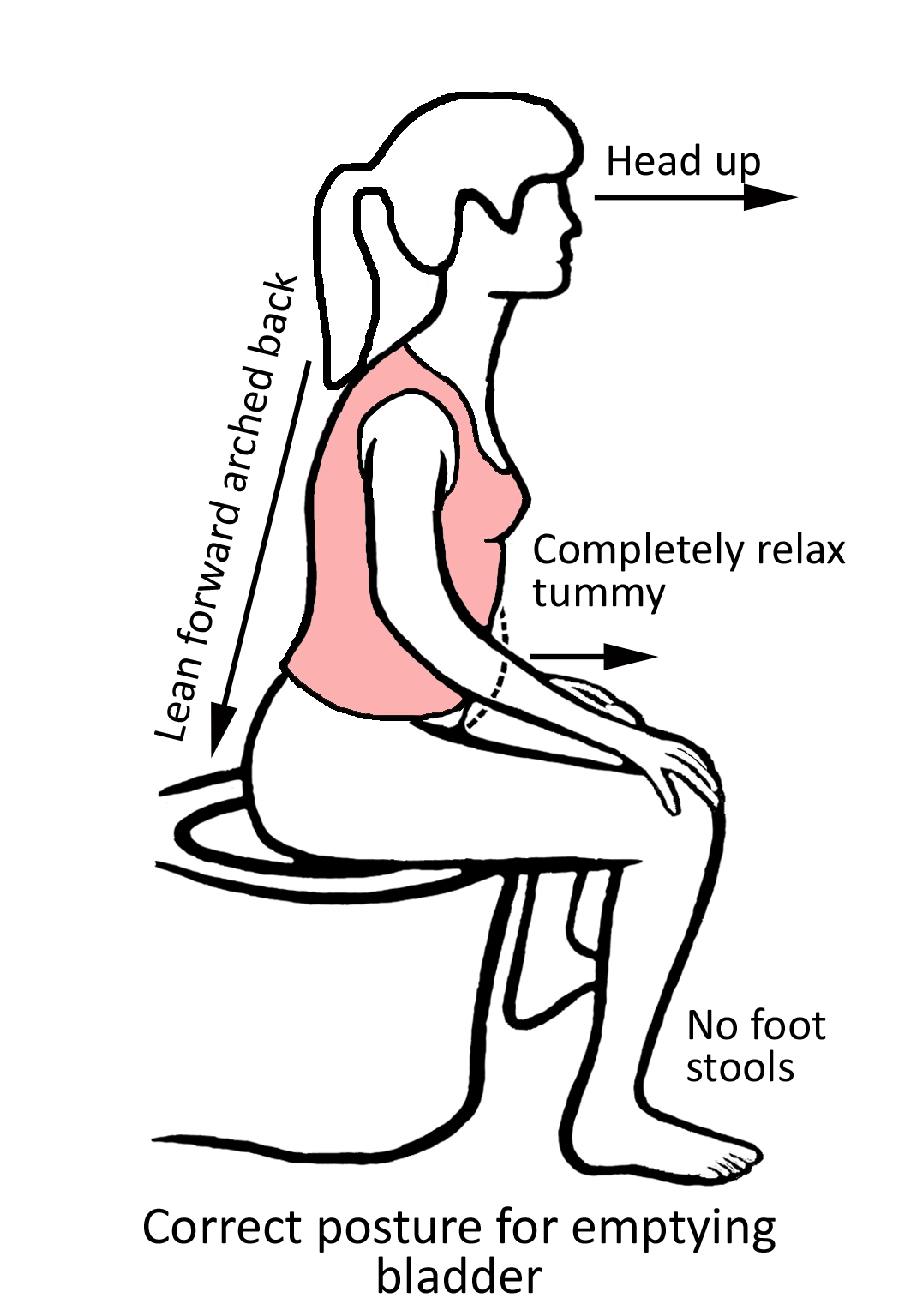 Analogies, Metaphors and How to Keep Pelvic Health Simple - Sue Croft ...